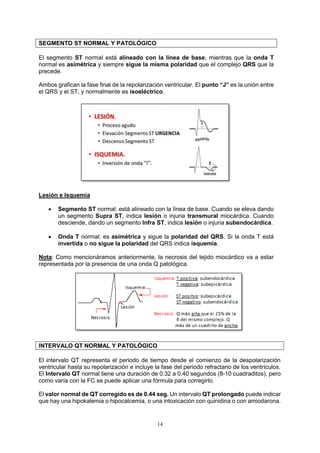 ECG FACIL | PDF