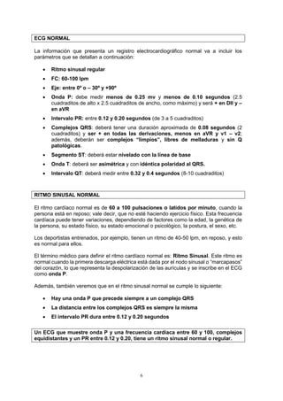 ECG FACIL | PDF