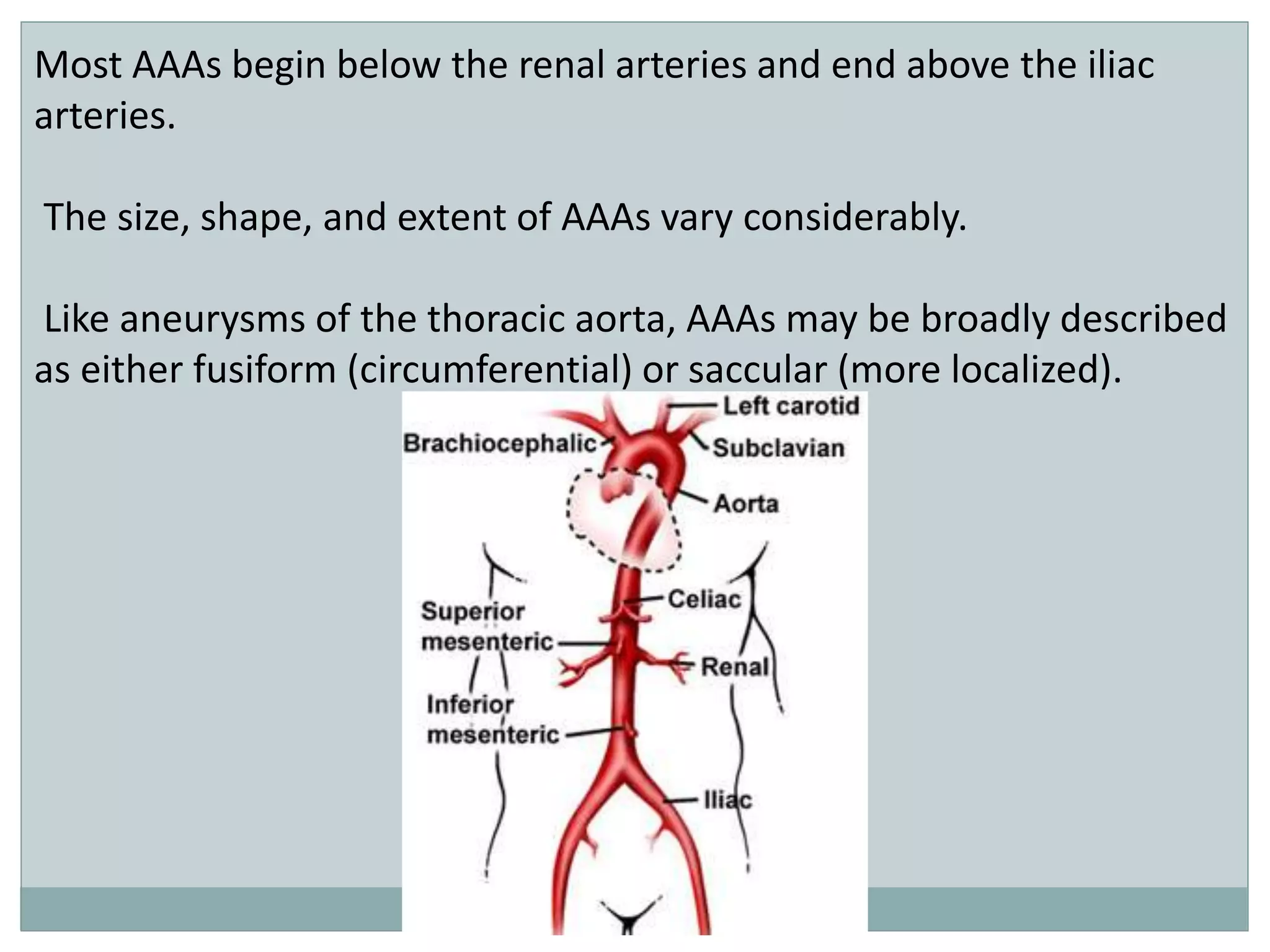 Aortic aneurysm imaging | PPTX