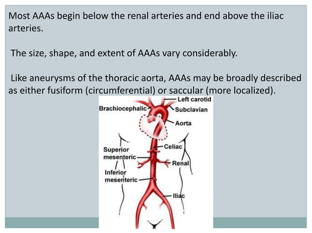 Aortic aneurysm imaging | PPTX | Digestive Disorders | Diseases and ...