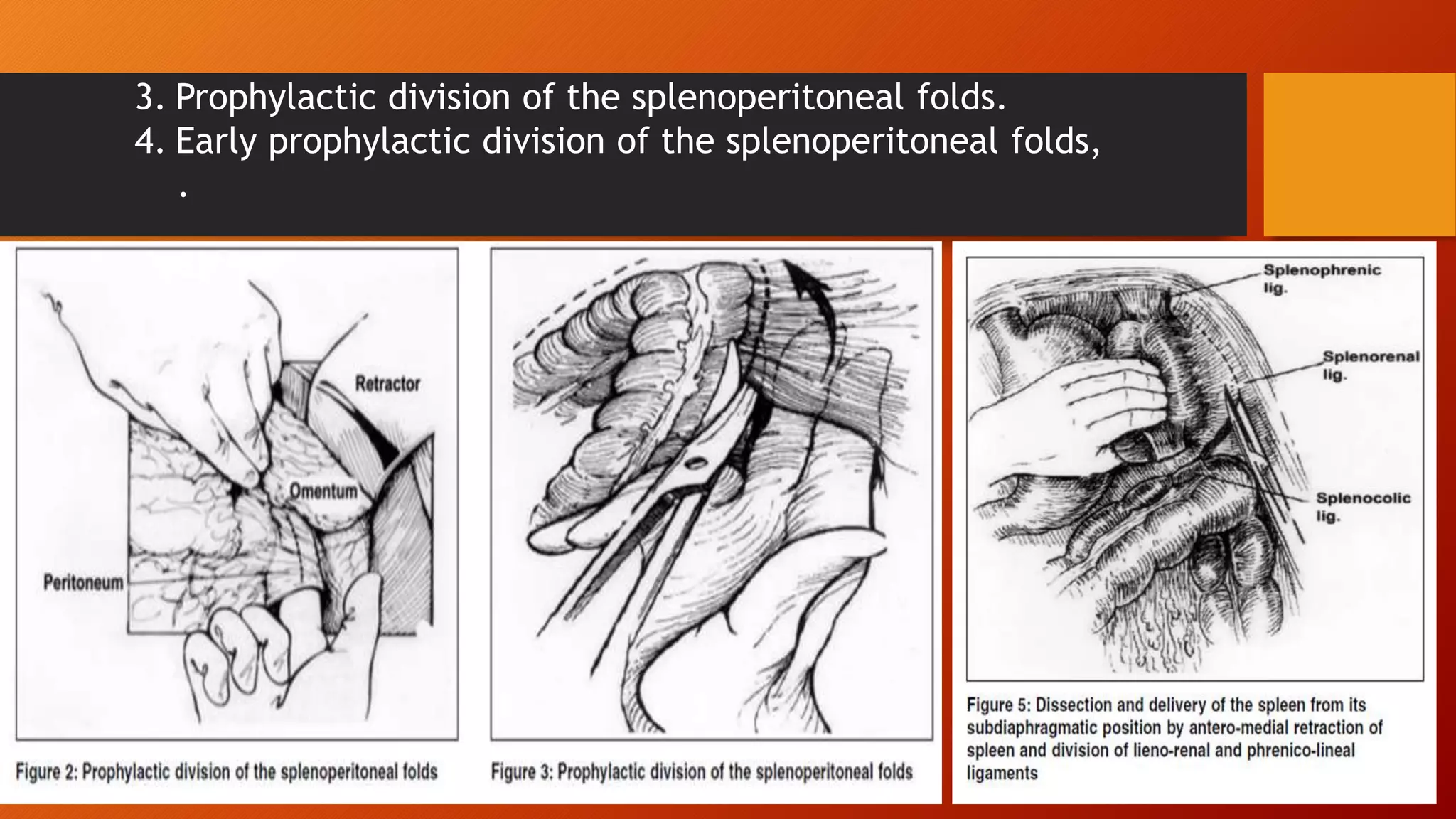 Cidera trauma Lien iatrogenik | PPT