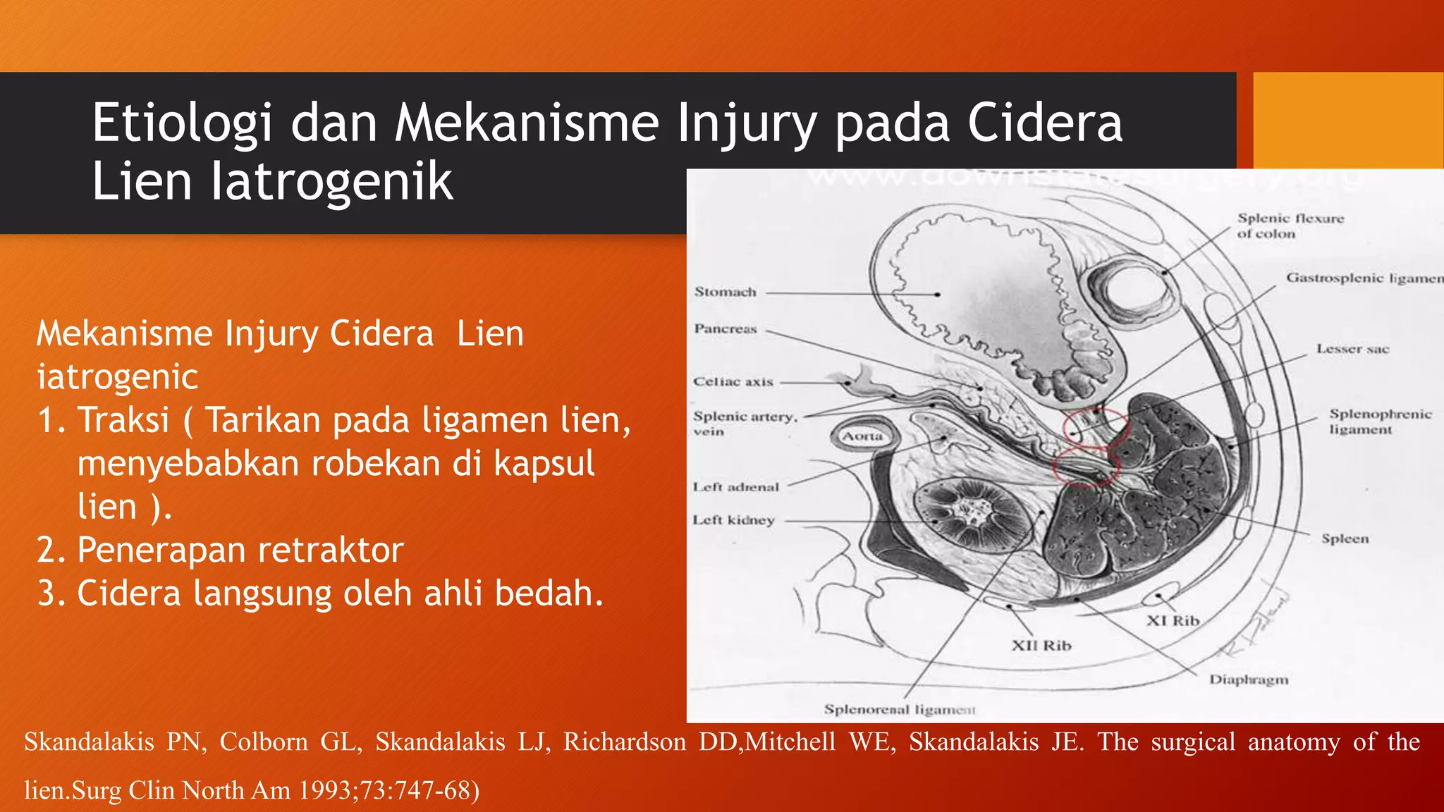 Cidera trauma Lien iatrogenik | PPT