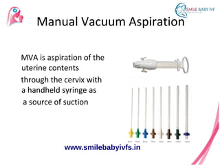 MVA in the management of first trimester abortions | ODP