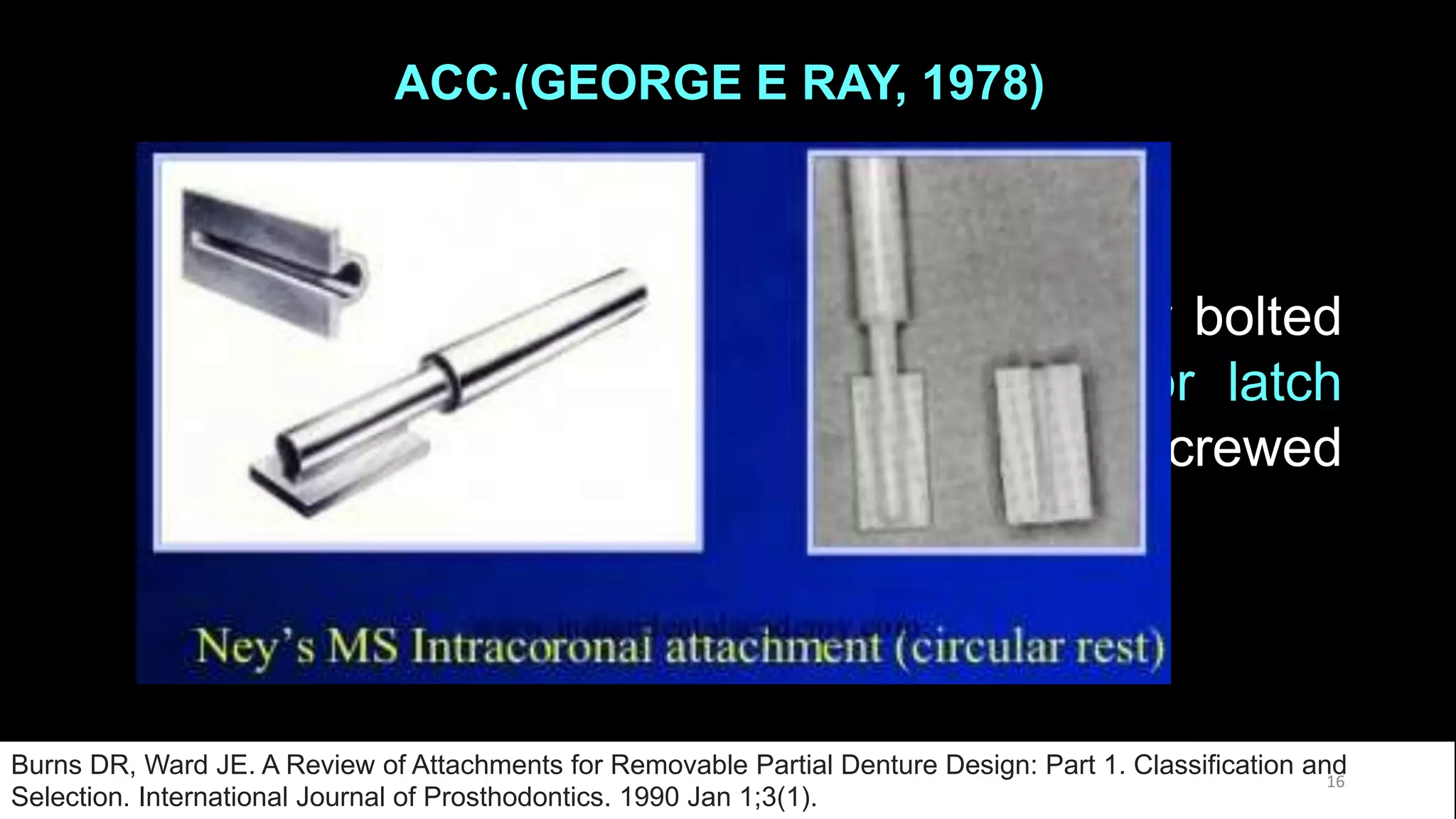 Precision attachments | PPTX
