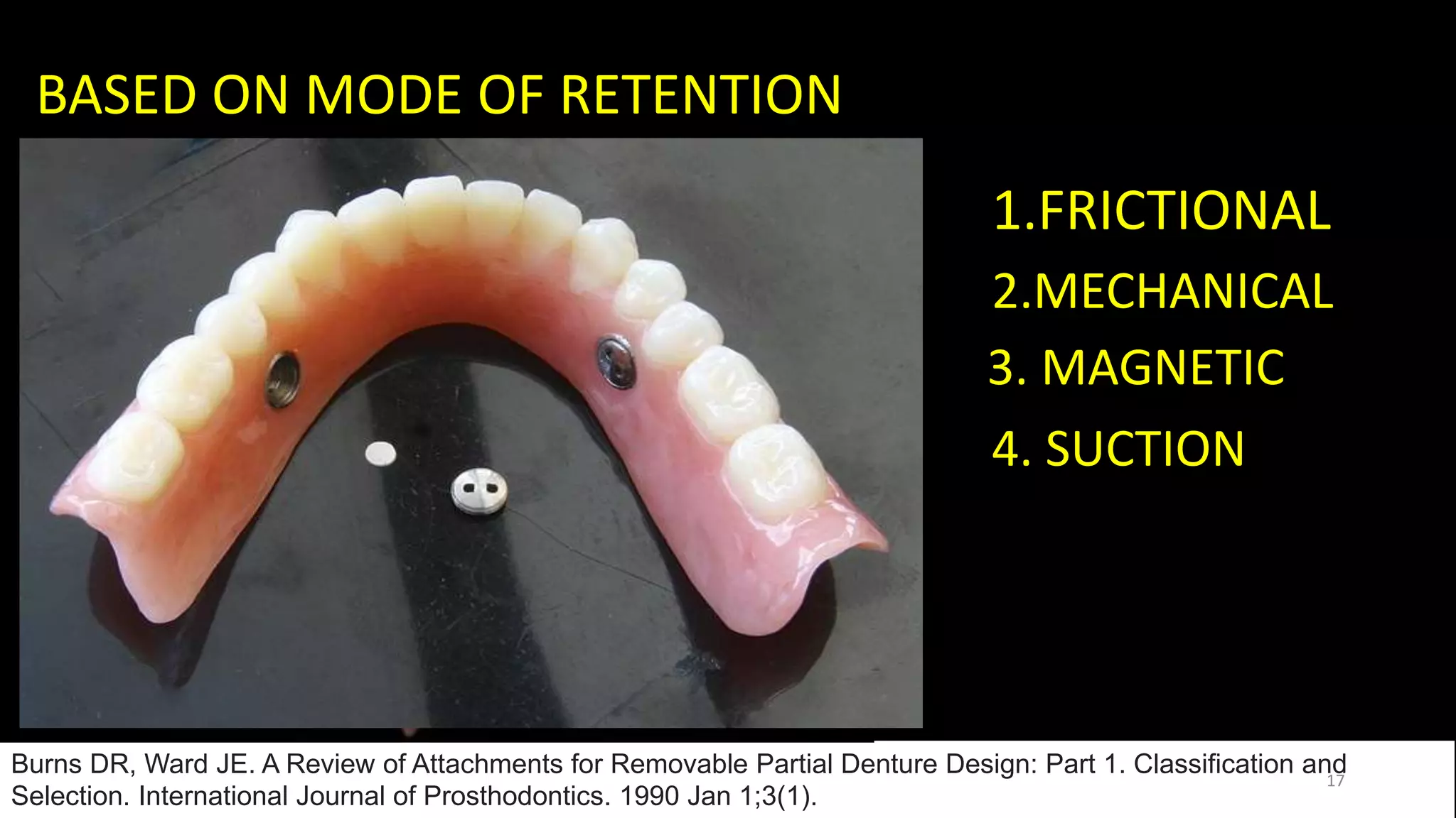 Precision attachments | PPTX