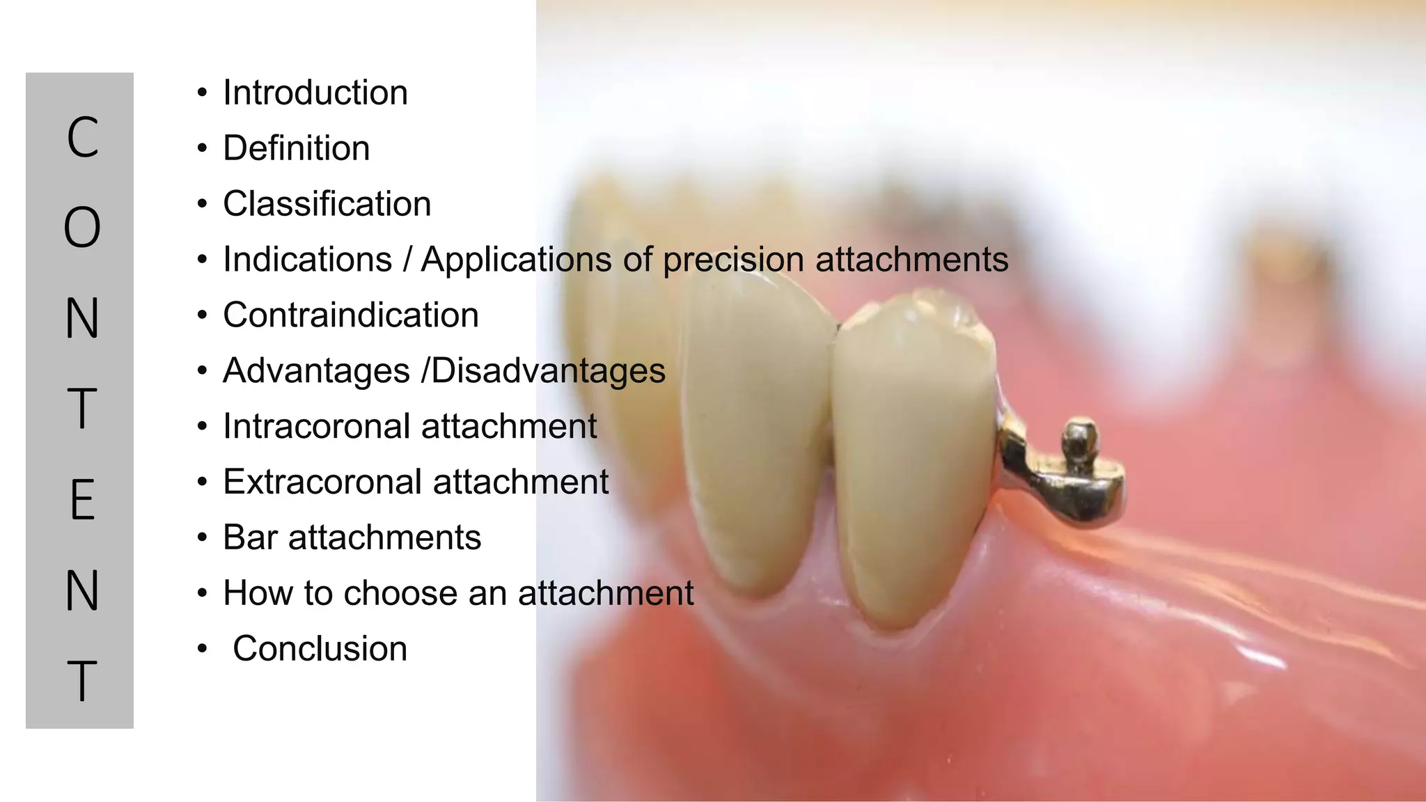 Precision attachments | PPTX