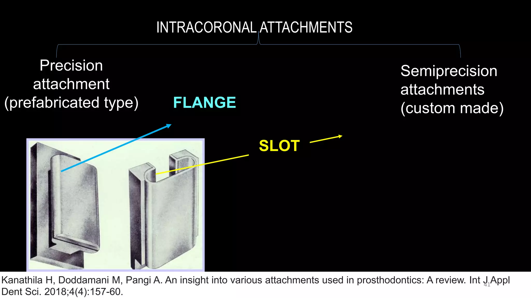 Precision attachments | PPT