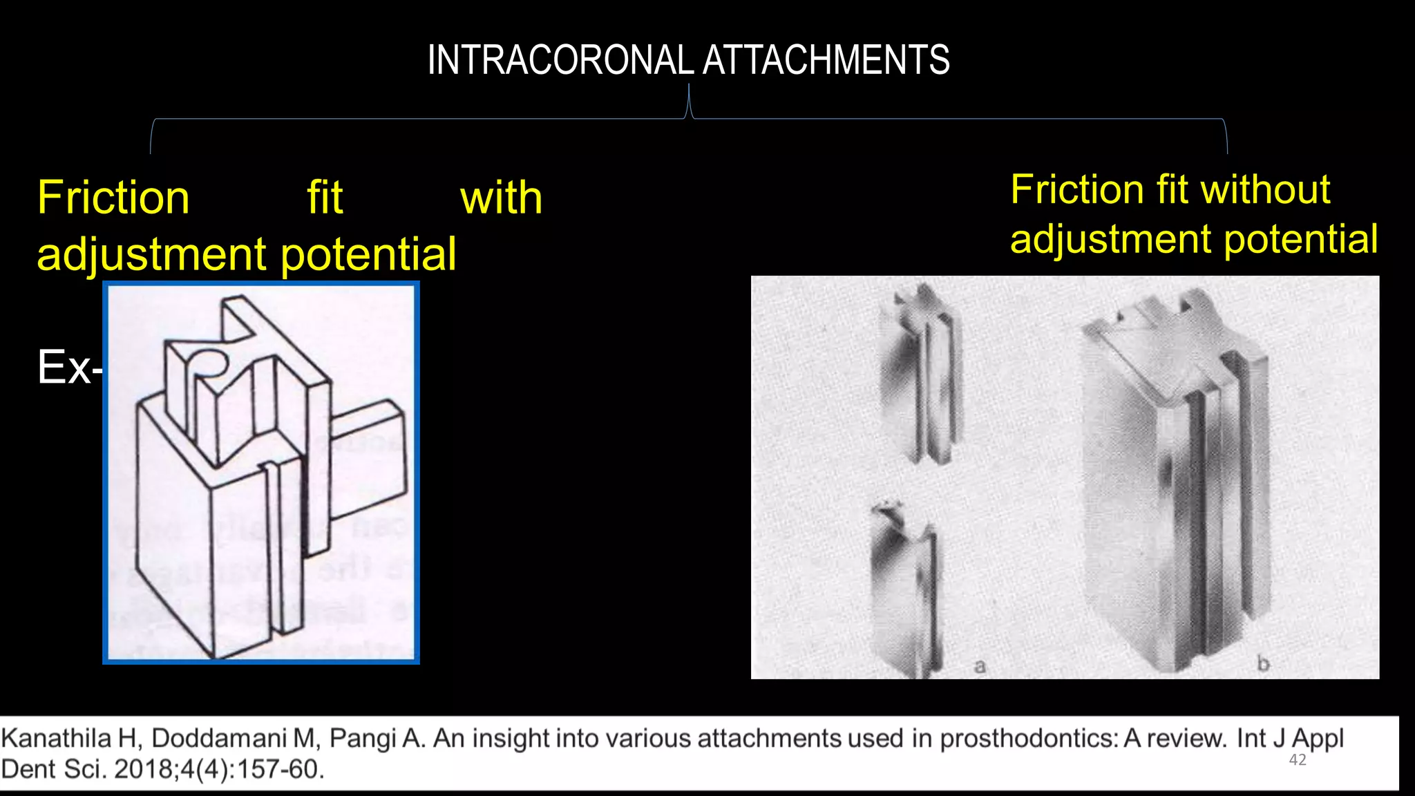 Precision attachments | PPTX