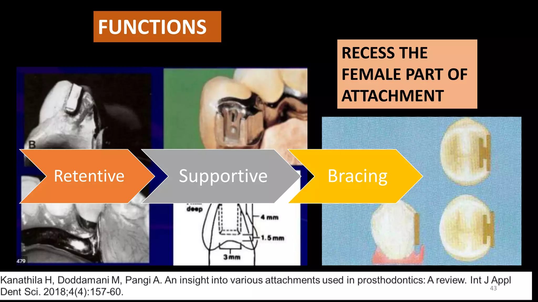 Precision attachments | PPTX