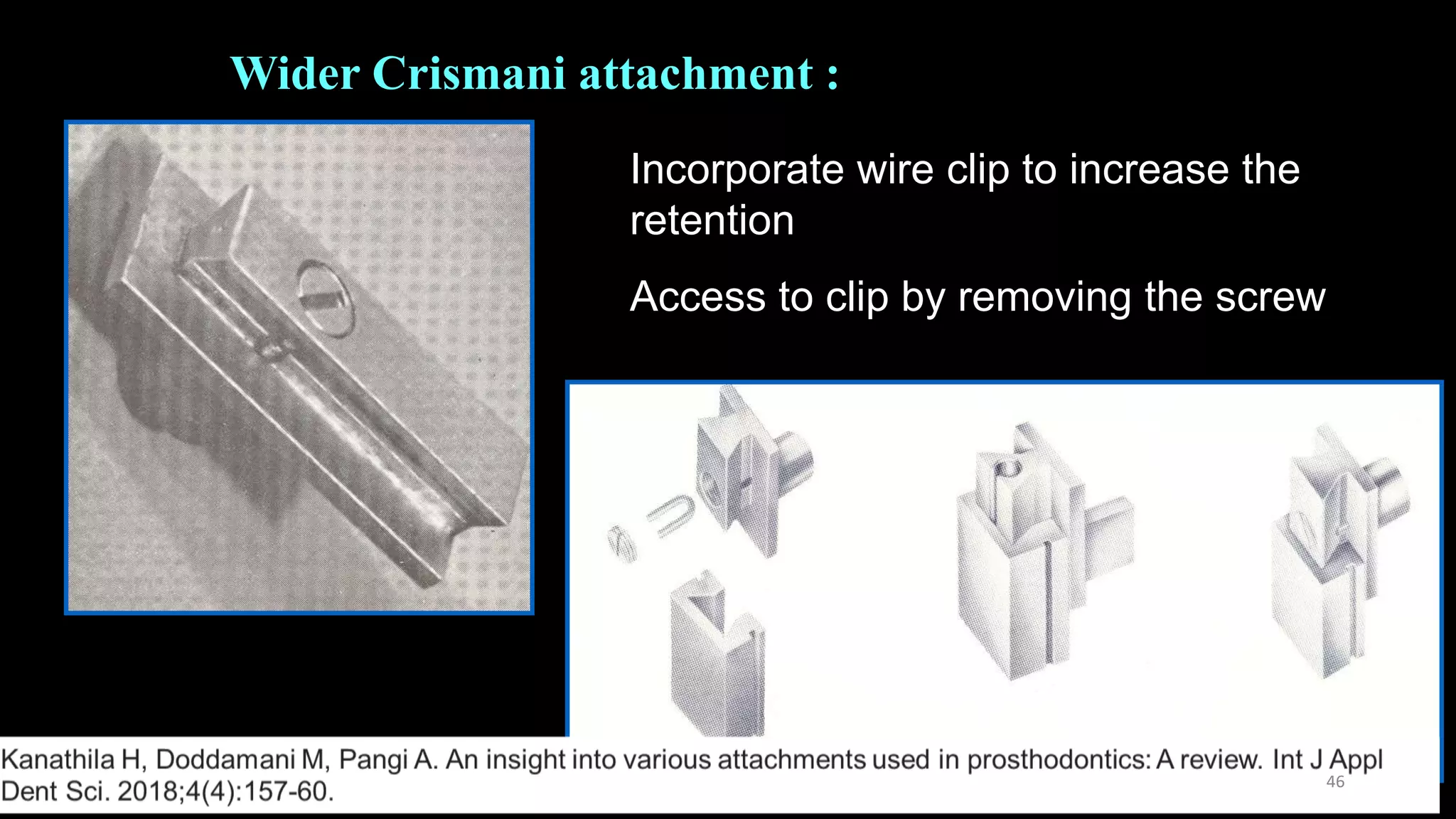 Precision attachments | PPTX