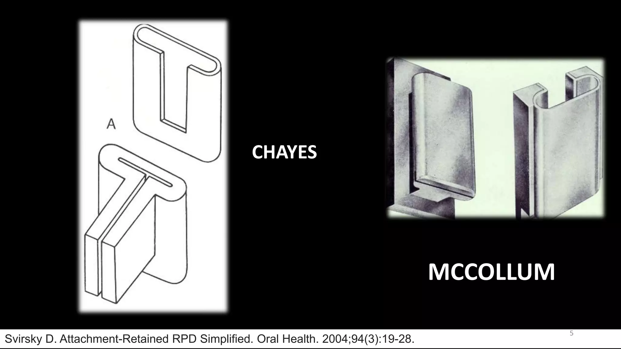 Precision attachments | PPTX