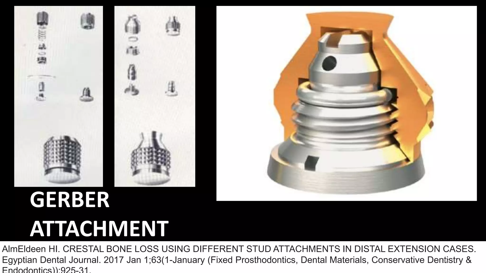 Precision attachments | PPTX