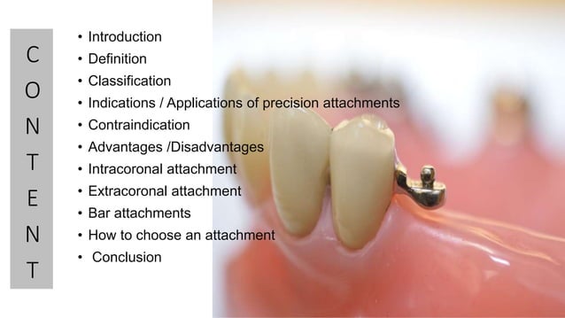 Precision attachments | PPTX