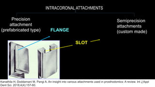 Precision attachments | PPTX