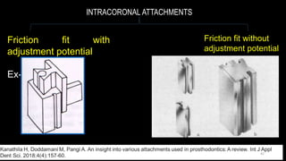 Precision attachments | PPTX