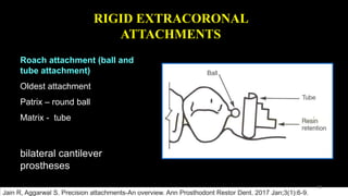 Precision attachments | PPTX