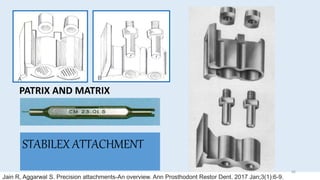 Precision attachments | PPTX