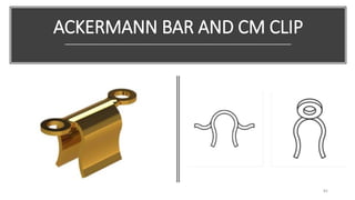 Precision attachments | PPTX