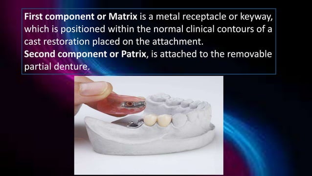 Precision attachments | PPTX