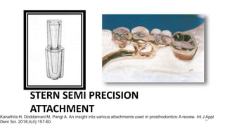 Semi Precision Attachment Abutment