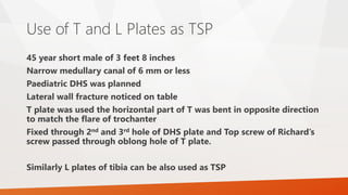Aam Aadmi TSP alias use of T and L plates as TSP | PPTX
