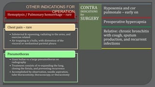 Surgery for Bullous Disease | PPTX