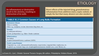 Surgery for Bullous Disease | PPTX