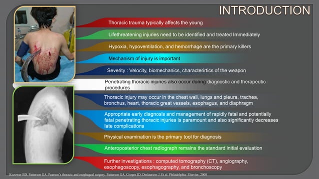 Penetrating Thoracic Trauma | PPTX