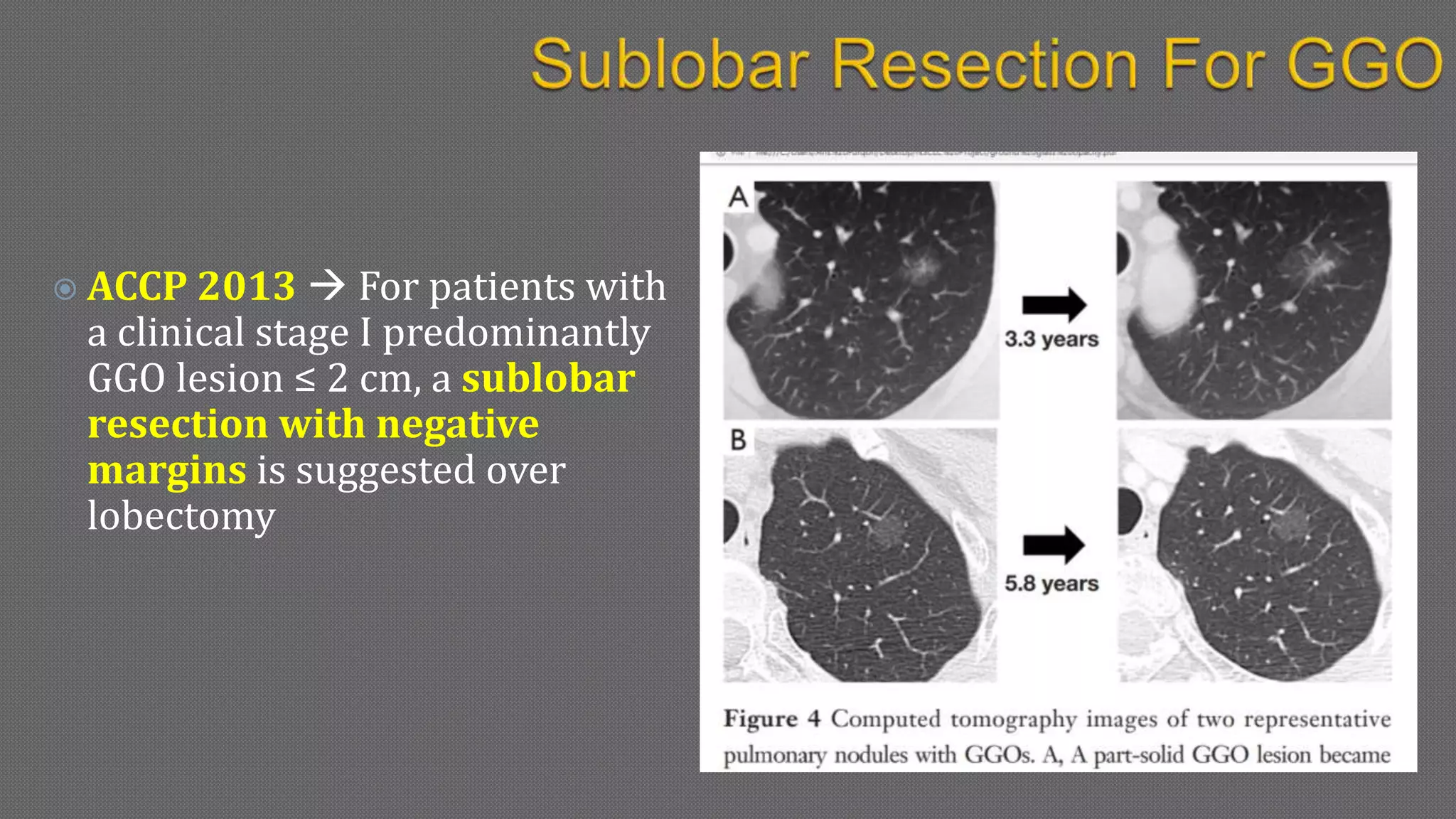 Surgical Management for Non Small Cell Lung Cancer | PPTX