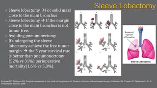 Surgical Management for Non Small Cell Lung Cancer | PPTX