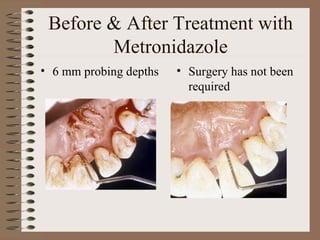 A antibiotics | PPT | Free download