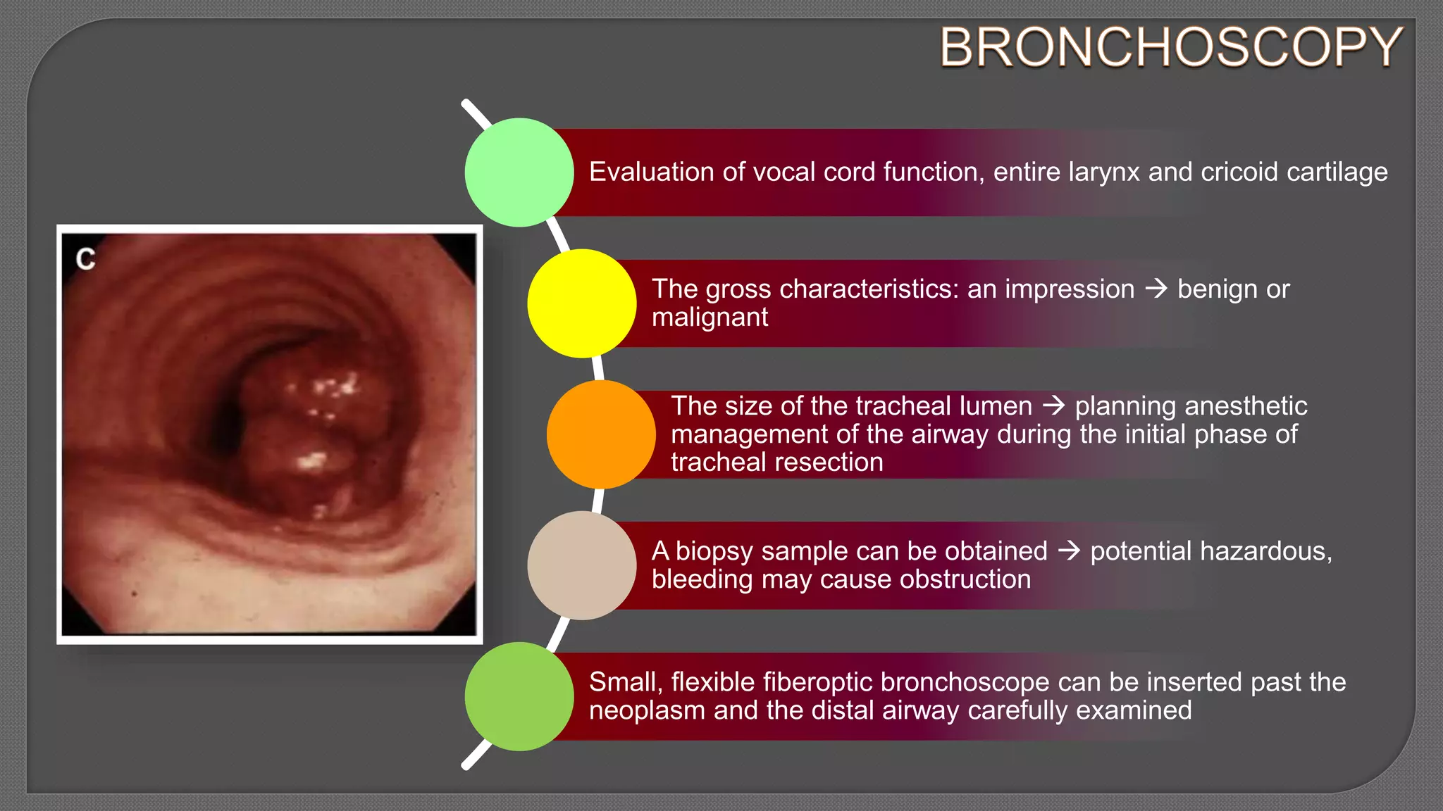 Tracheal Tumor | PPTX