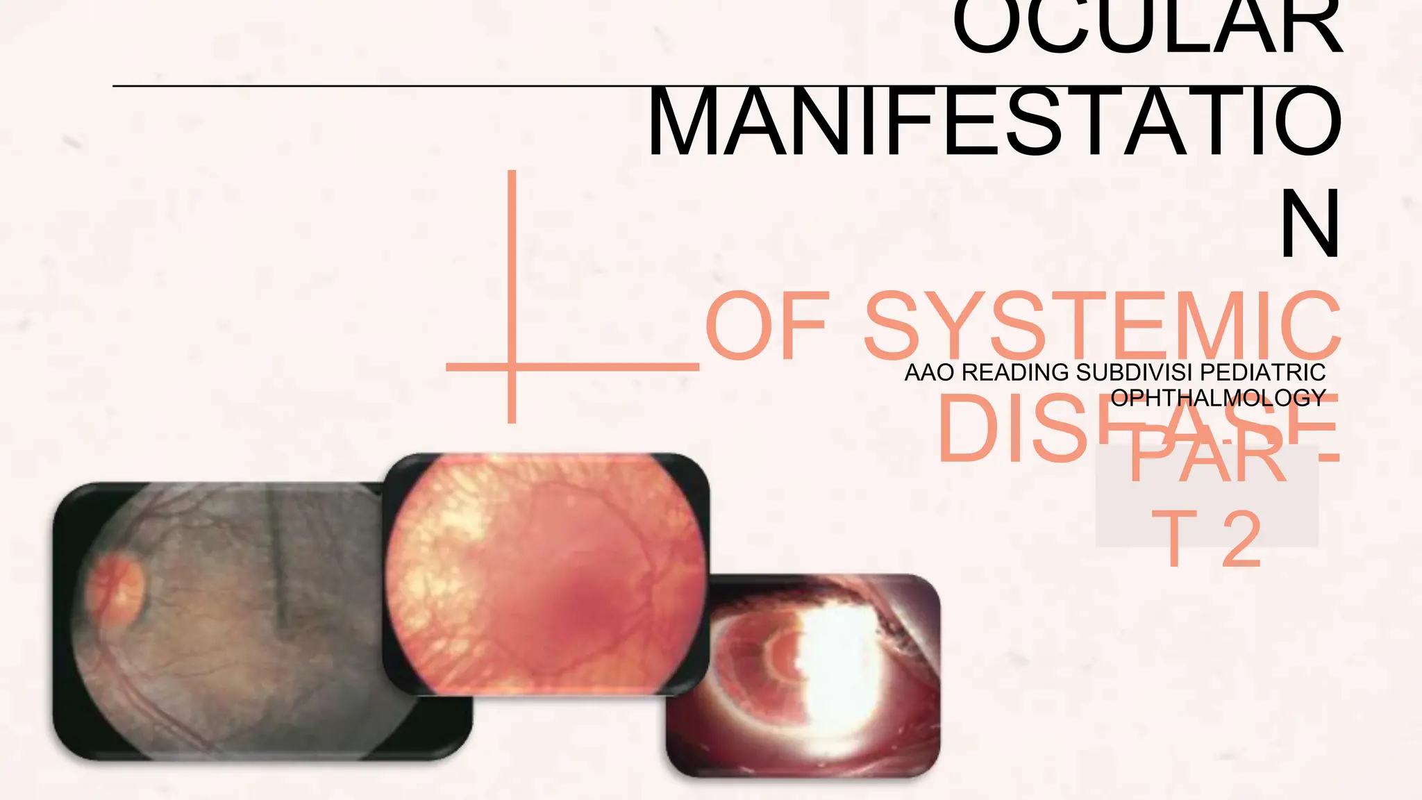 Ocular manifestation of systemic disease Part 2 DID.pptx