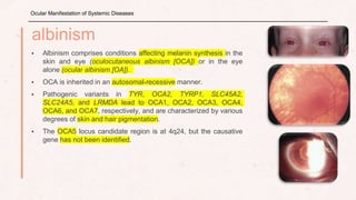 Ocular manifestation of systemic disease Part 2 DID.pptx