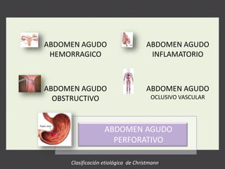 Abdomen agudo perforativo | PPTX