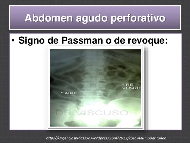 Abdomen agudo perforativo