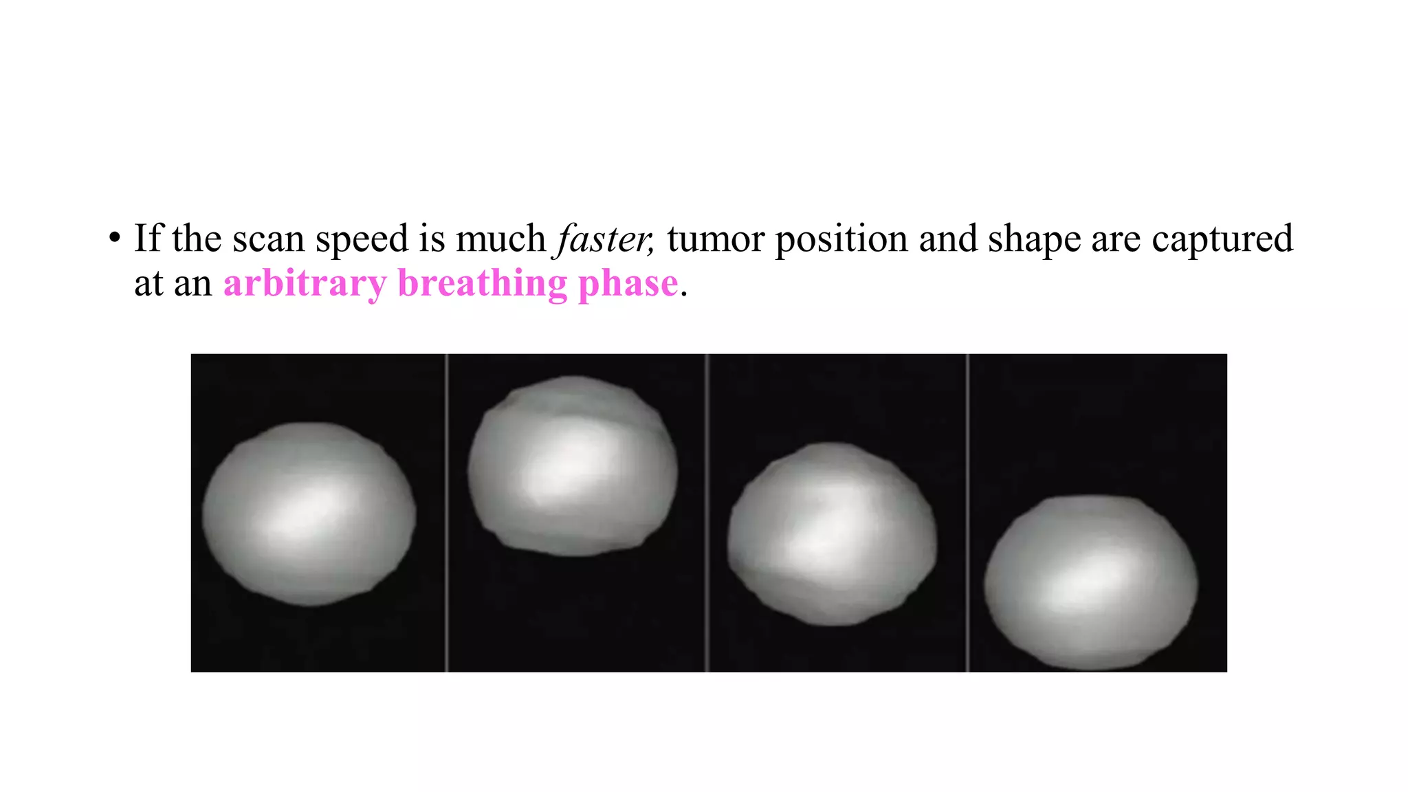 Motion management techniques in RT | PDF