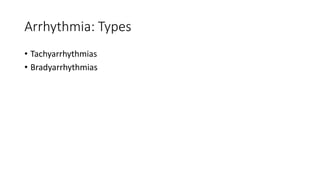 Cardiac Arrhythmia: A brief overview for UG MBBS Students | PPTX