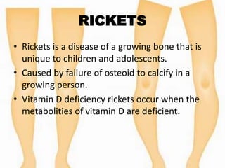 physiotherapy Management in obesity,osteoporosis,diabetes,rickets | PPTX