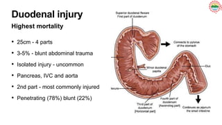 AAST grading - Bowel/Intestinal Injury | PPTX