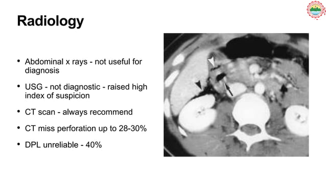 AAST grading - Bowel/Intestinal Injury | PPTX | First Aid | Injuries