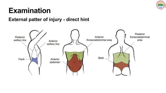 AAST grading - Bowel/Intestinal Injury | PPTX | First Aid | Injuries