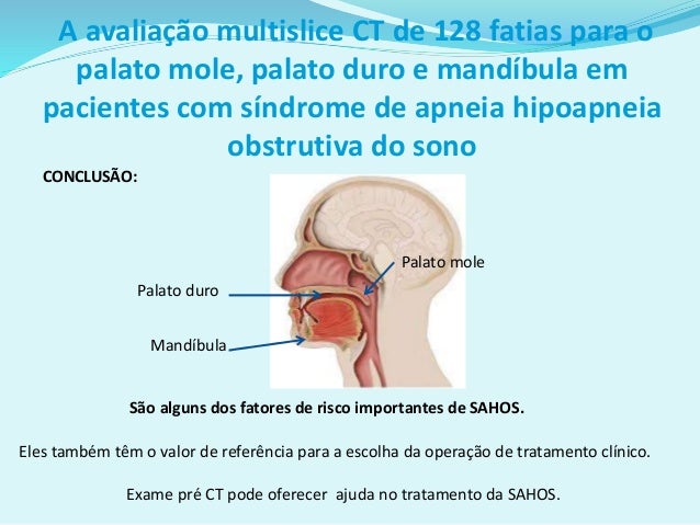 A avaliação multislice CT de 128 fatias para o palato mole, palato duro ...