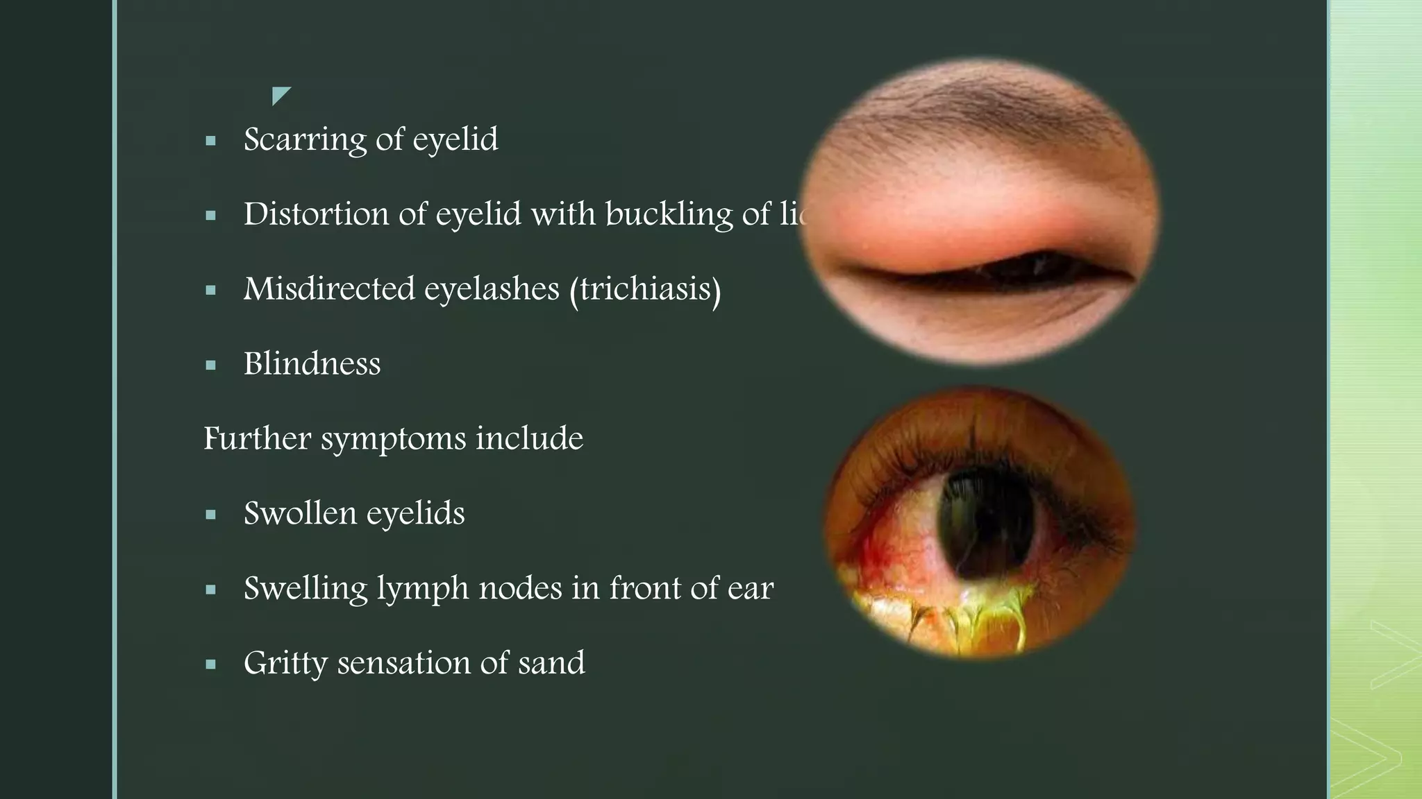 tetanus and trachoma | PPTX