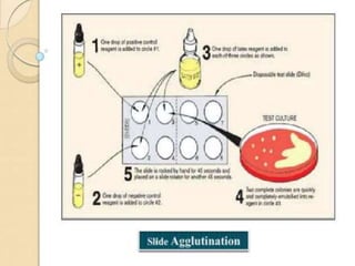 Antigen-Antibody Reaction (Ab Ag Reaction) | PPTX | Chemistry | Science