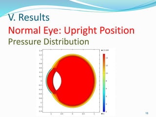 Presentation-LinkedIn | PPTX | Eye and Vision Conditions | Diseases and ...