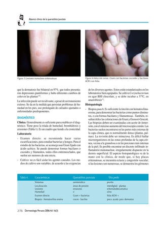 Abanico clínico de la queratólisis punctat | PDF