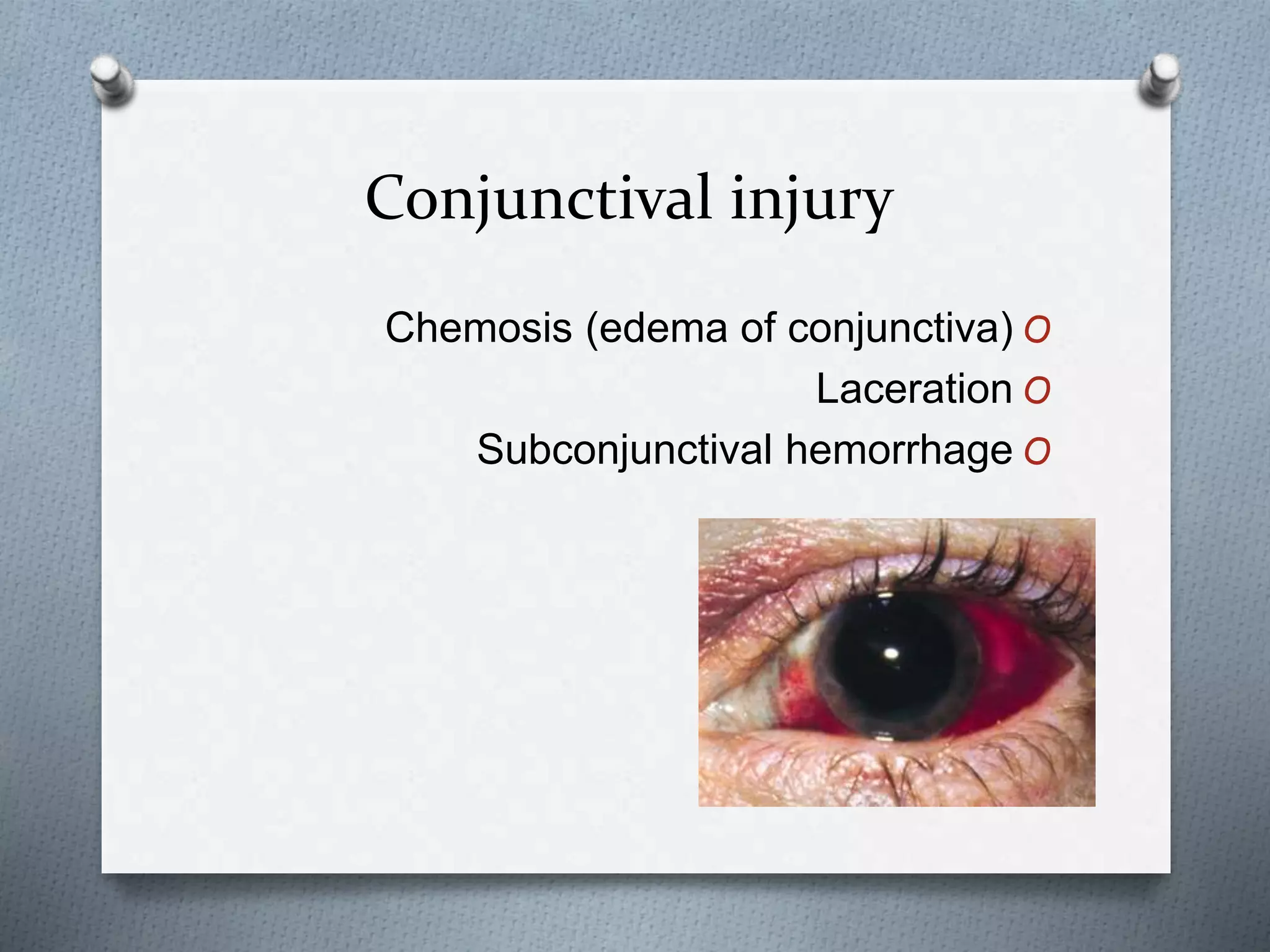 eye trauma approach and management | PPTX