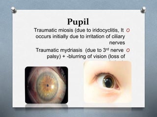 Traumatic Mydriasis