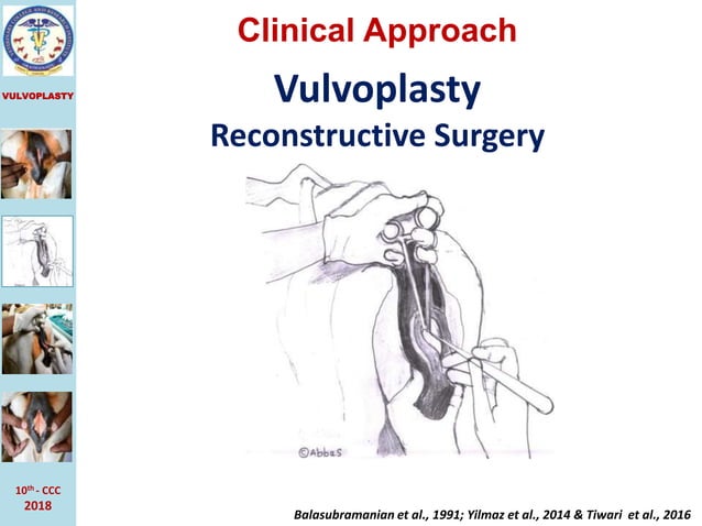 Vulvoplasty to Correct Congenitally Fused Labia Vulva in a Jersey ...